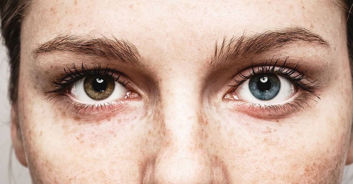 How Can Eye Color Change With Mood?